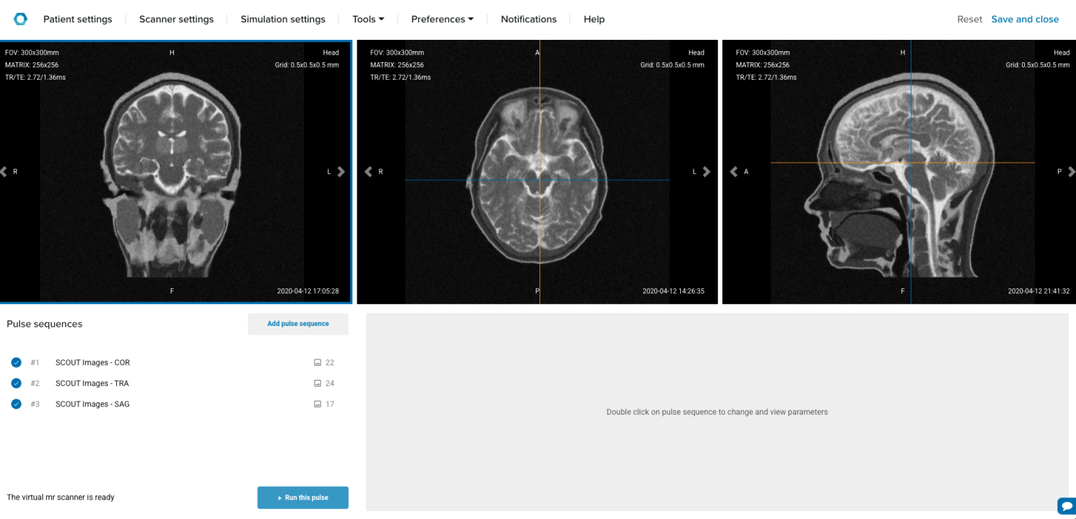 MRI Technologist Program, Diagnostic Ultrasound & Nurse Training Des ...